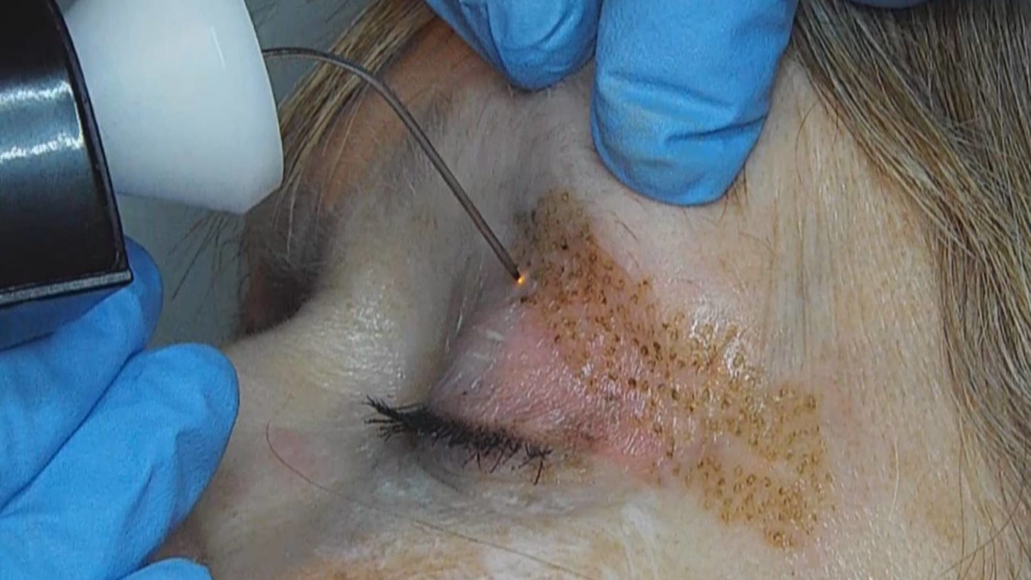 Electrical Arcing and the European MDD in 2020 – VoltaicPlasma – Areton LTD